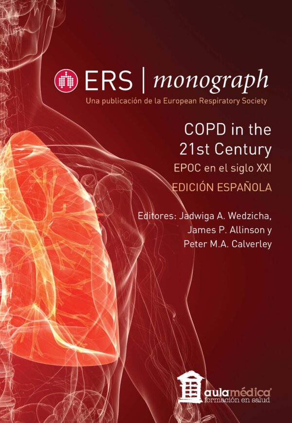ERS | Monograph EPOC en el siglo XXI - COPD in the 21st Century EDICIÓN ...